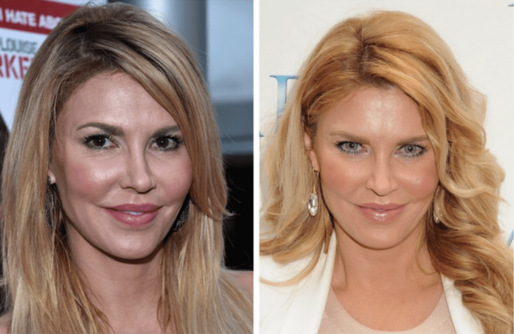 Has RHOBH Star Brandi Glanville Had More Face Work Done? - The Real ...