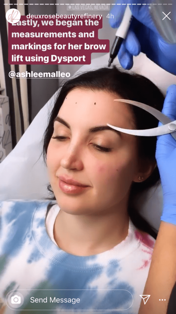 RHONJ’s Ashlee Holmes Gets Full Face of Filler – See Her Before and ...
