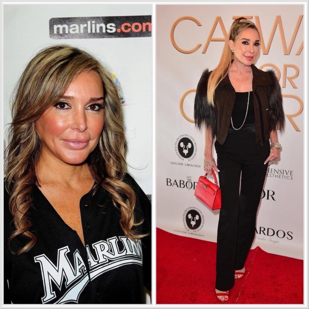 Real Housewives of Miami - Plastic Surgery