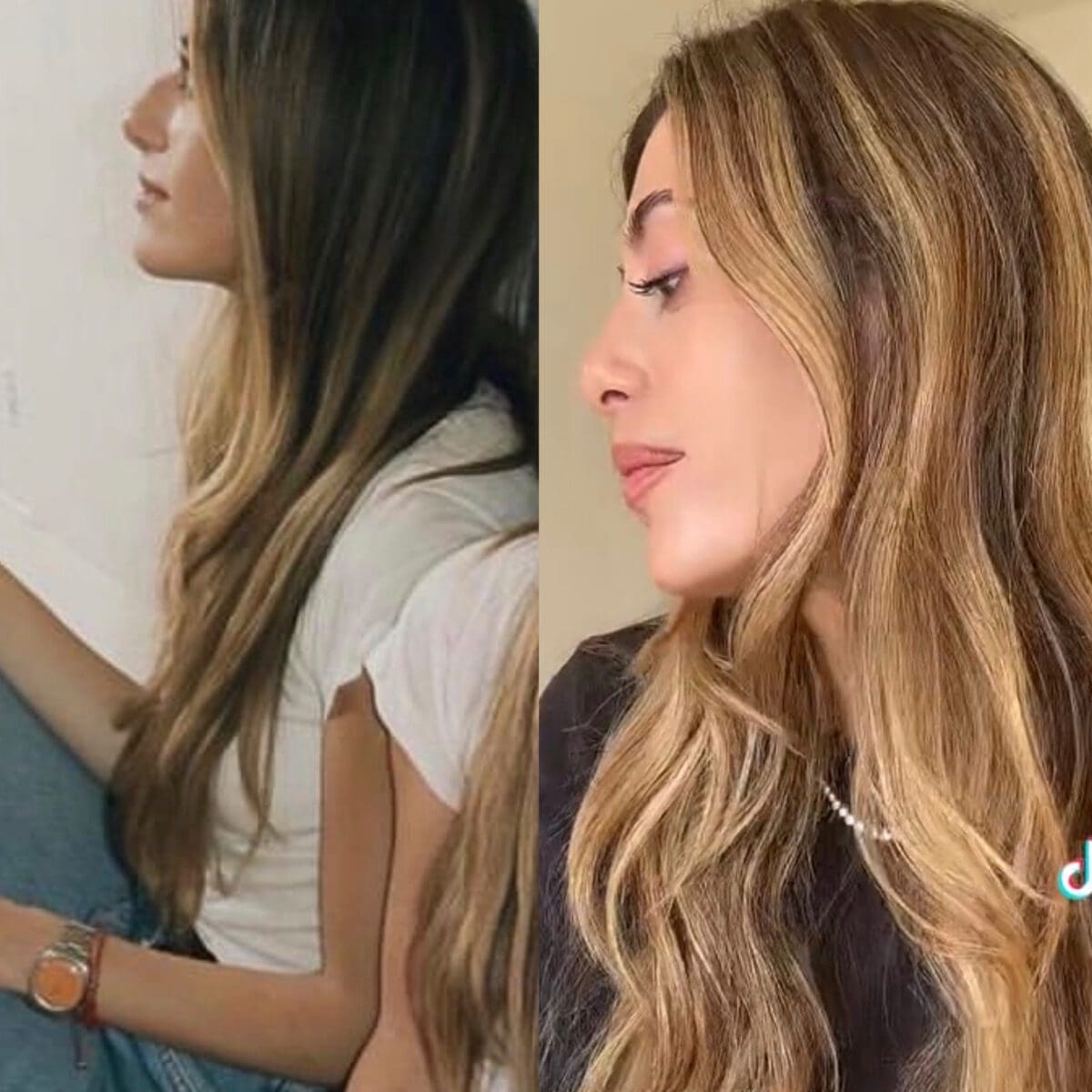 RHONJ: Dina Manzo's Daughter Lexi Manzo Debuts Nose Job - See Her ...