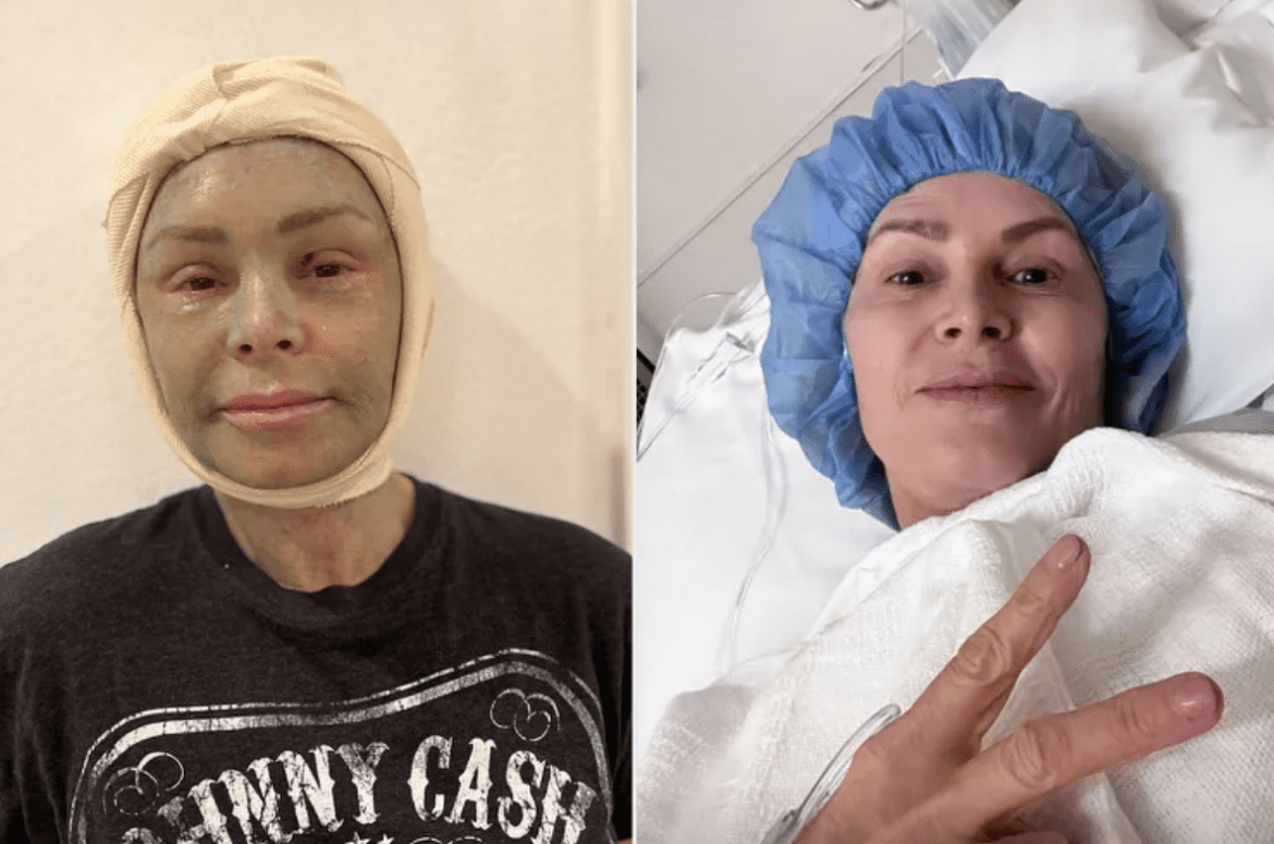 Lisa Barlow Talked Out of Getting Same Laser as Tamra Judge